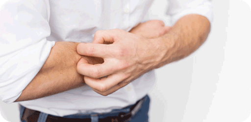 How to Get Rid of Itchy Skin for PC - Free Download & Install on ...