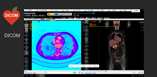 DICOM for PC - Free Download & Install on Windows PC, Mac
